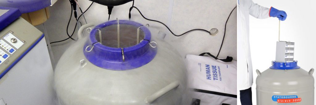 Biorack | Biomedical Material | Statebourne Cryogenics